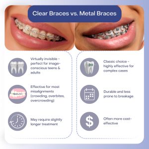 Clear Braces Hackensack, NJ | Dental Invisible Braces in New Jersey