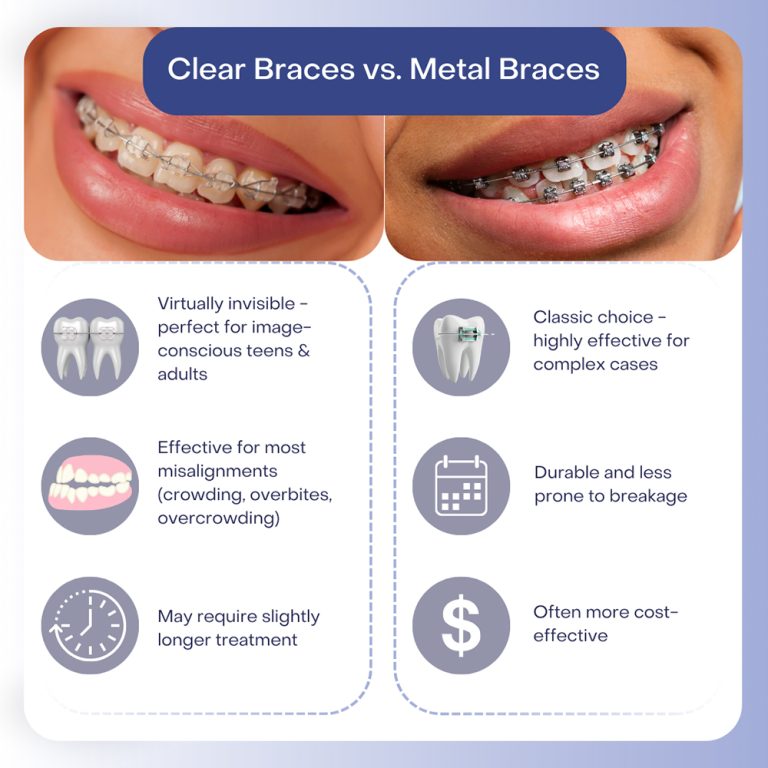 Clear Braces Hackensack, NJ | Dental Invisible Braces in New Jersey