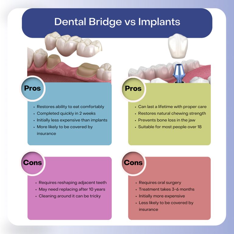 Dental Bridge vs Implants | My New Jersey Dentist Hackensack