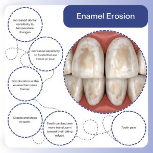 Enamel Erosion Treatment in Hackensack, NJ | My New Jersey Dentist