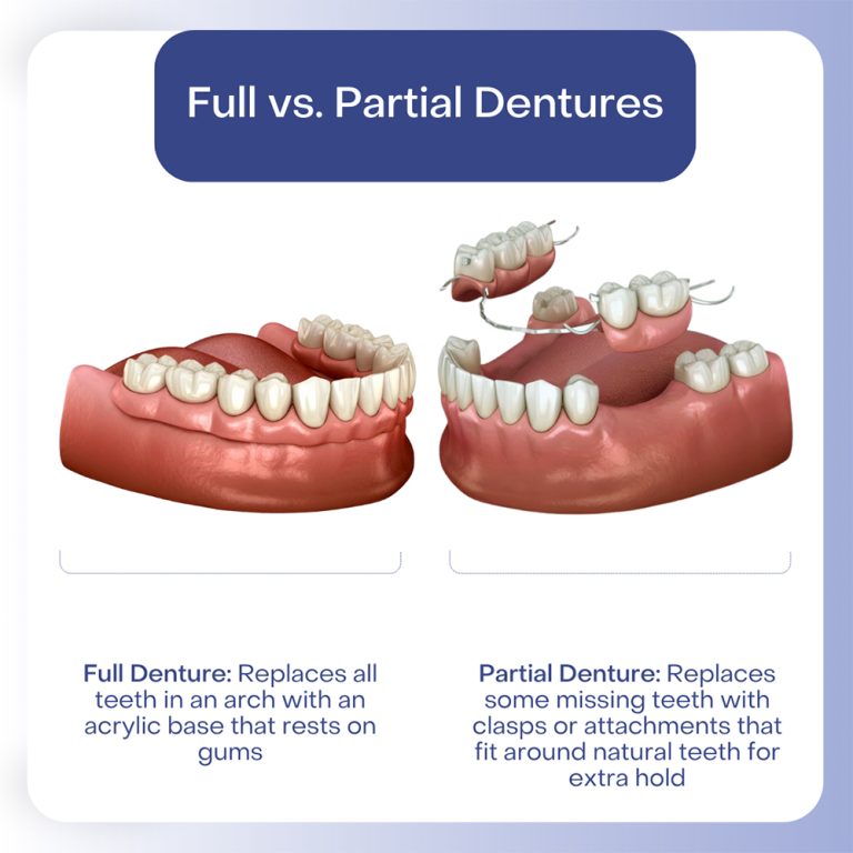 Full & Partial Dentures Hackensack, NJ | Affordable Dentures Hackensack