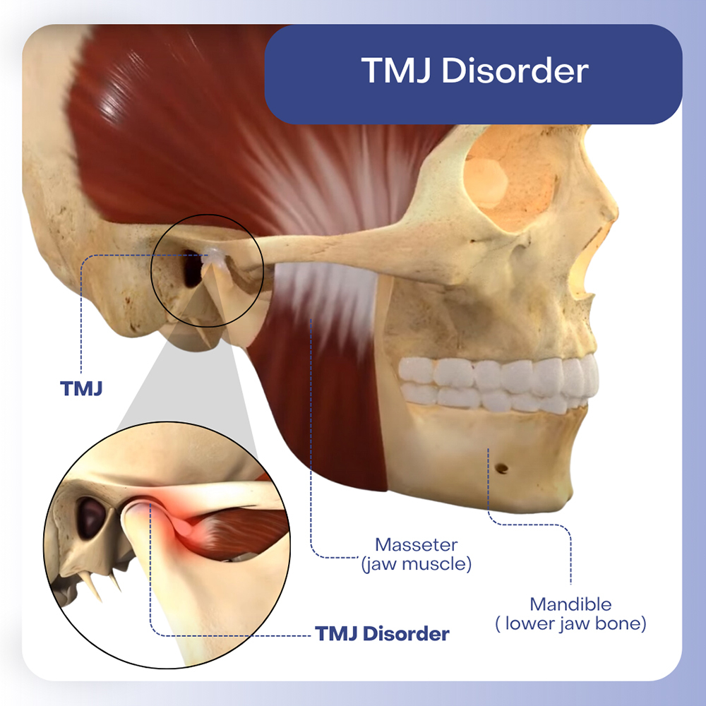 TMJ Treatment Hackensack NJ Top Rated TMJ Dentist TMJ Treatment Hackensack NJ Top Rated TMJ Dentist