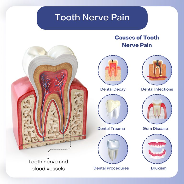 Tooth Nerve Pain Treatment Hackensack | My New Jersey Dentist