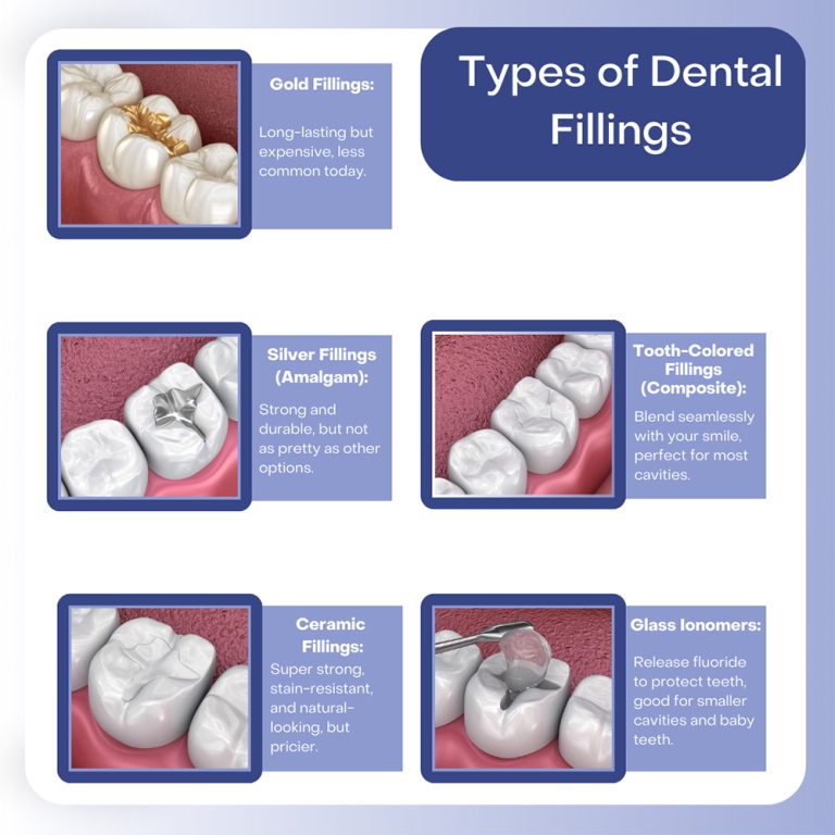 Dental Fillings Hackensack, NJ | Cavity Filling Hackensack, New Jersey